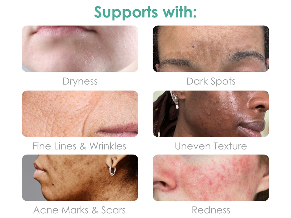 Youth Effect | Bakuchiol Pro-Aging Face Oil