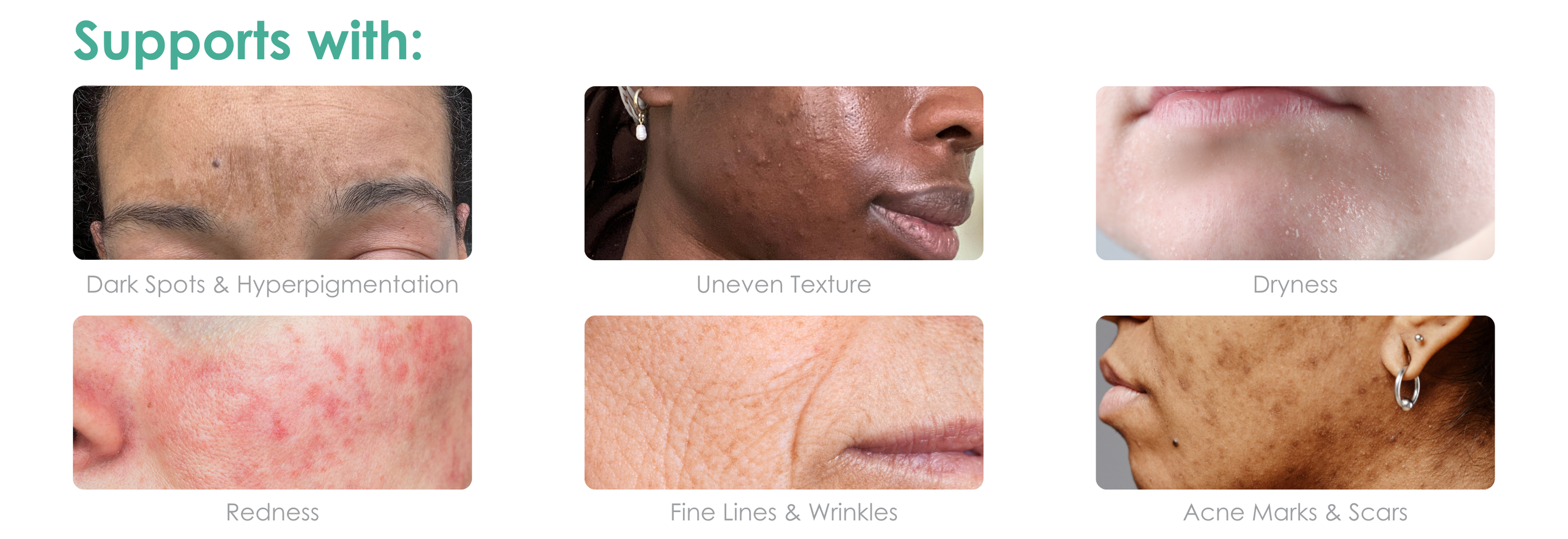 Youth Effect | Bakuchiol Pro-Aging Face Oil